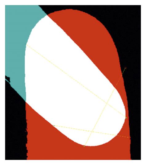 Stages Of Rotation Alignment Method Applied To Four Images Ad Input Download Scientific