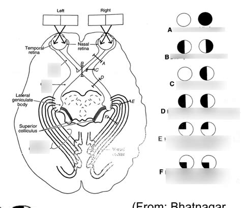 Visual Pathway Lesions Unit Exam 3 Week 5 Diagram Quizlet