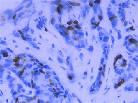 Image Pixel Size And Qupath Image Analysis Imagesc Forum