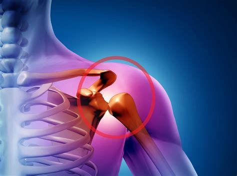 Упражнения для снятия боли в плечах