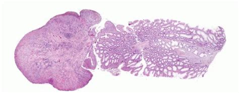 Colon Abdominal Key