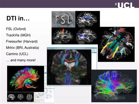 Ppt Diffusion Tensor Imaging Powerpoint Presentation Free Download