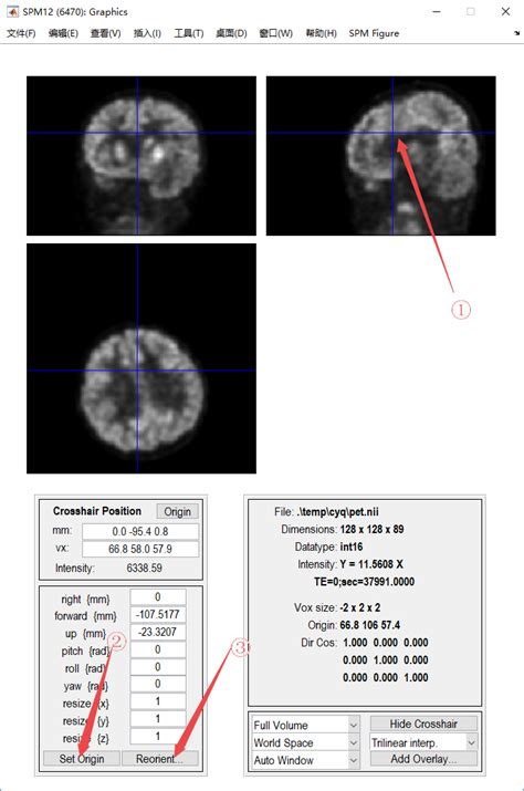 构建多模态影像模型的基础 Matlab配准 3dslicer 经验分享 3dslicer龙虾社区