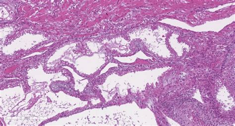 Hande 10× The Glandular Cells Of The Decidualized Endometrium In The Download Scientific
