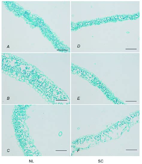 Leaf Anatomy Of Soybean Plants Under Normal Light Nl A C And Shaded