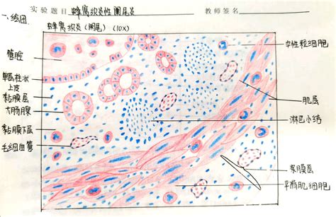 病理学切片红蓝铅笔画图 哔哩哔哩