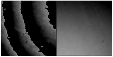 Efficiency Of Phase Unwrapping And Image Filtering Algorithms Implemented In A Fpga Applied On