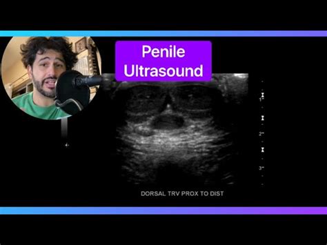 Ultrasound Penile Anatomy Review Of The Role Of Imaging In The