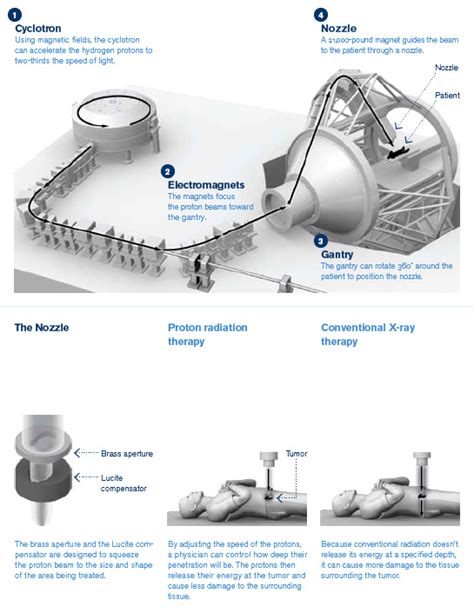 Cyclotron Proton Therapy