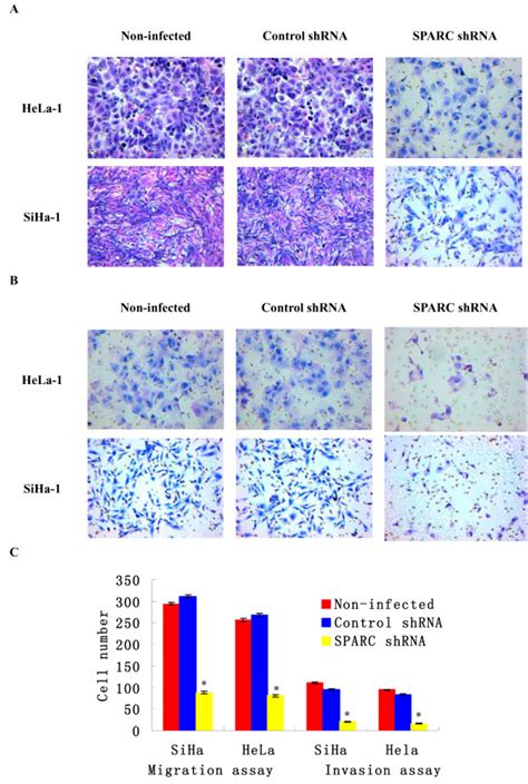 Effects Of Sparc Knockdown On Cell Migration And Invasion A The Download Scientific Diagram