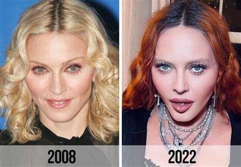 Madonna Looks ‘unrecognizable Now—a Plastic Surgeon Weighs In Shefinds