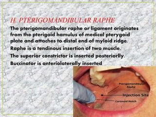 Anatomical Landmarks Mandibular Prosthodontics Pptx