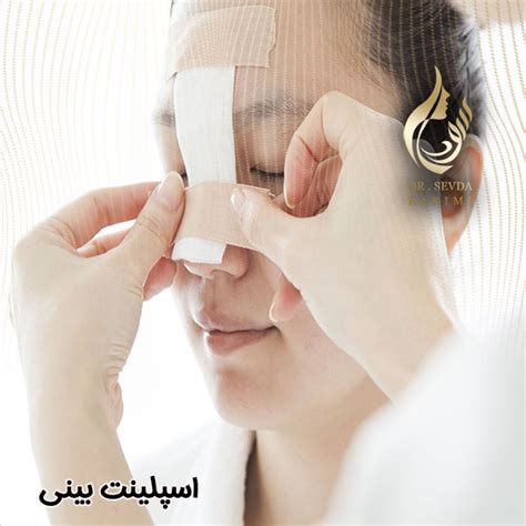 اسپلینت بینی دلایل ، مزایا و معایب استفاده از اسپلینت