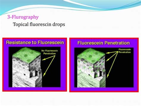 Collagen Cross Linking Ppt Pptx