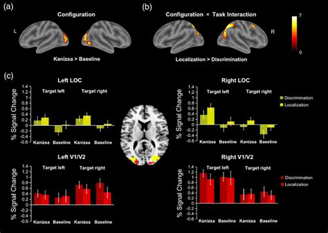 Surface Rendering Of The Functional Magnetic Resonance Imaging Fmri Download Scientific
