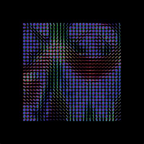 Reconstruction Of The Diffusion Signal With Dti Single Tensor Model