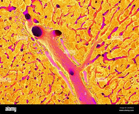 Liver Vein Coloured Scanning Electron Micrograph Sem Of Liver Tissue Showing A Large Vein