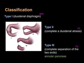 Duodenal Atresia Pdf