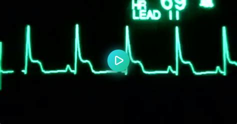 Heart Attack Album On Imgur