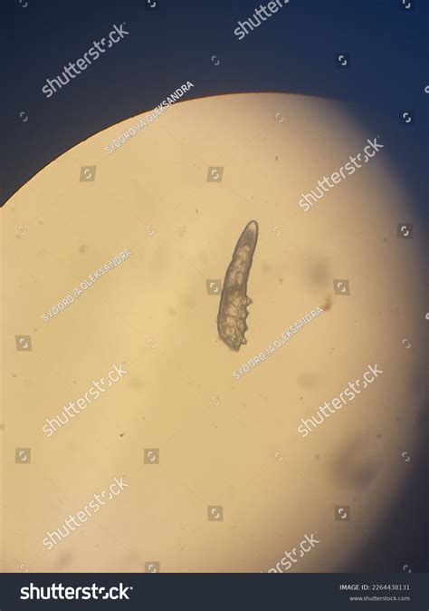 Eyelash Under Microscope