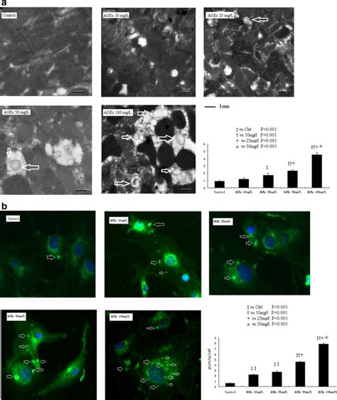 Advanced Glycation Endproducts Trigger Autophagy In Cadiomyocyte Via Rage Pi3k Akt Mtor Pathway