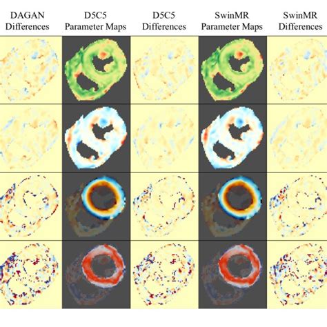 Diffusion Parameter Maps Of The Reconstruction Results Af ×2 And The