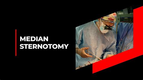 Median Sternotomy Срединная стернотомия 👍 Youtube