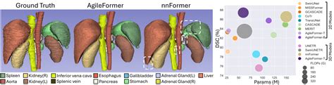 论文审查 Agileformer Spatially Agile Transformer Unet For Medical Image