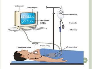Icu Monitoring PPTX