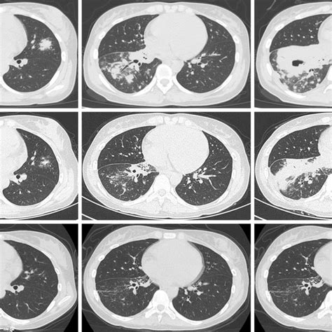 Computed Tomography Images A Thoracic Computed Tomography Ct Images Download Scientific