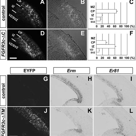 Disruption Of Proper Radial Migration Of Cortical Neurons By