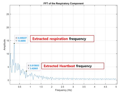 Estimated Respiration And Heartbeat Frequency Download Scientific Diagram