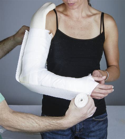 Upper Extremity Splints And Casts Musculoskeletal Key