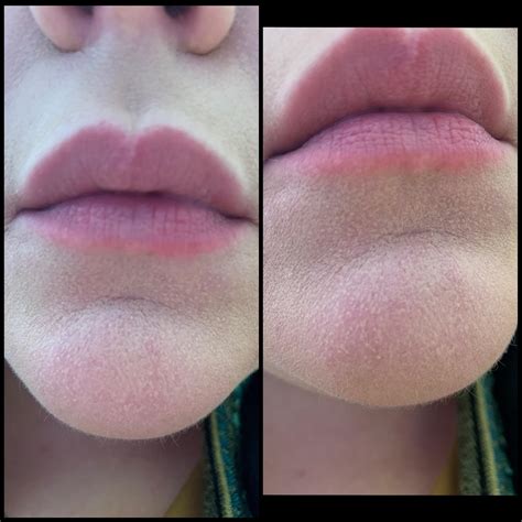 FOUNDATION SEPARATION At My Wits End Trying To Find A Solution More Explained In My