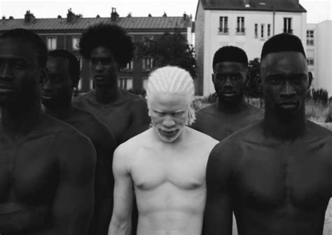 ალბინოსების უნიკალური სილამაზე სურათები ფაქტები