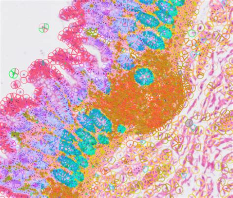 Xenium In Situ High Plex Sequencing By Bia Separations Cro