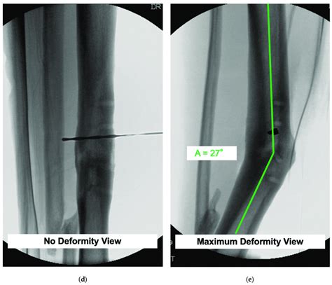 See Case Description For Details A E Demonstrate How To Calculate Download Scientific