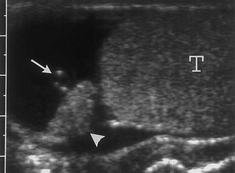 From The Archives Of The Afip Radiographics