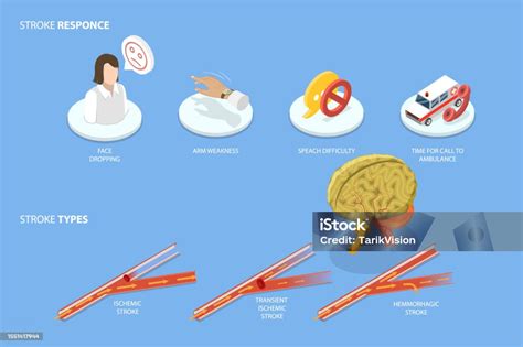 3d 아이소메트릭 플랫 벡터 개념 그림은 뇌 혈액 공급 문제 3차원 형태에 대한 스톡 벡터 아트 및 기타 이미지 3차원 형태 낮 뇌 Istock
