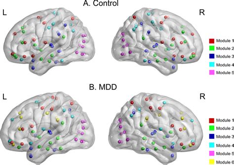 The Modular Organization Of Group Averaged Functional Brain Network At Download Scientific