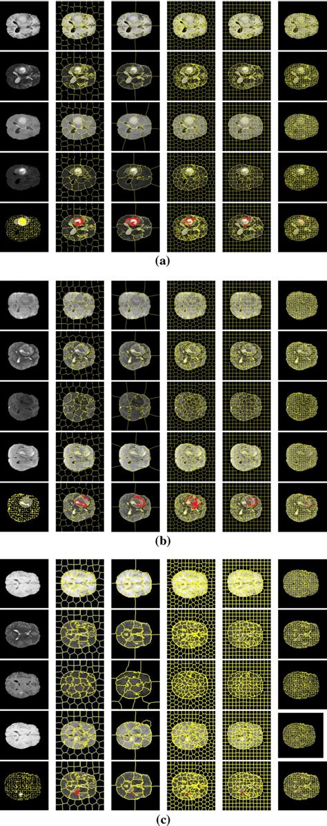 the segmentation results under different methods are in three groups of