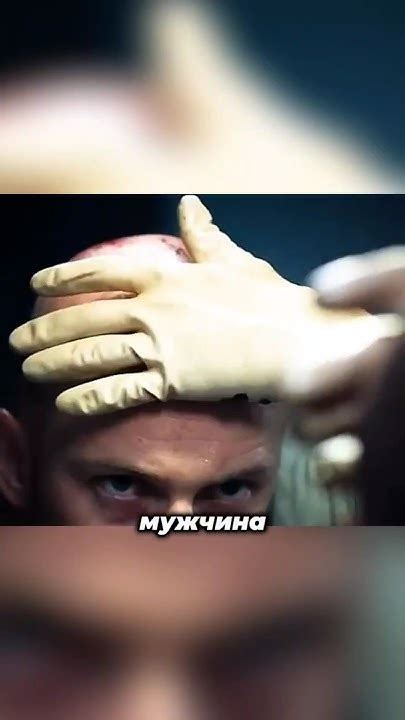 Мужчина хотел отрастить волосы средством для волос, но он ошибся ...