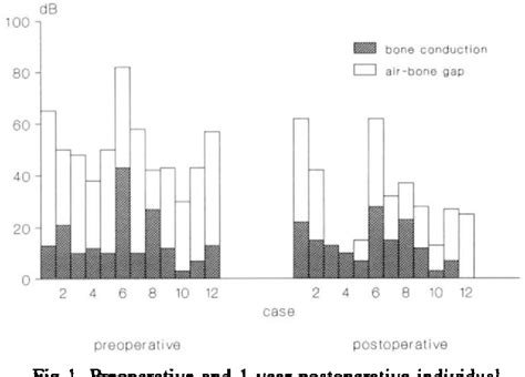 Figure 1 From Classification Of Congenital Middle Ear Anomalies Report On 144 Ears Semantic