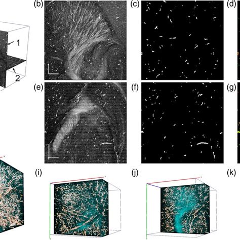 PS OCT Contrasts Of A Mouse Brain With TiO 2 Particles In The Download Scientific Diagram