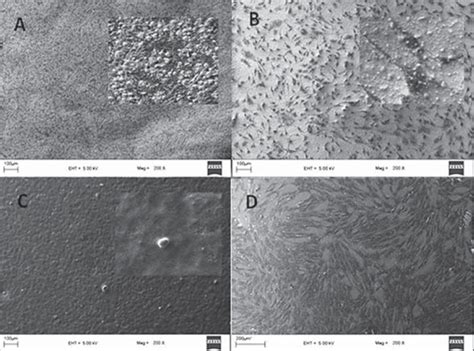 Scanning Electron Microscopy Sem Analysis Of Human Tooth Germ Stem