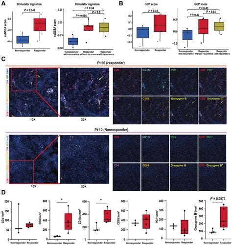 树突状细胞（dc）疫苗联合过继性t细胞辅助疗法应用于抗肝癌复发的临床研究 全景组织细胞定量分析系统 肿瘤免疫微环境分析 组织流式定量分析