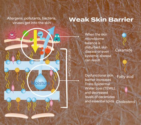 Repair Your Skin Barrier Naturally To Improve Eczema Conditions Celrevive