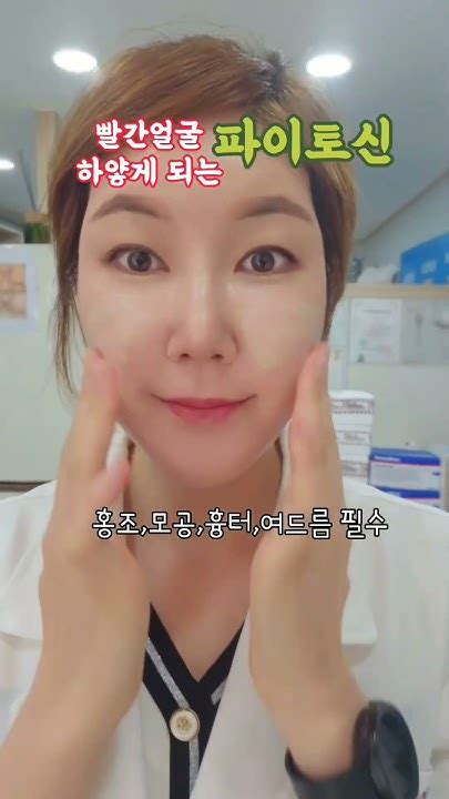 고개만 숙여도 빨개지고 성공 확언 외칠때도 빨개지는감정에따라 홍당무가 되는 얼굴 파이토신 거제여드름 거제피부관리 여드름 에스테틱 피부관리 통영피부관리 통영