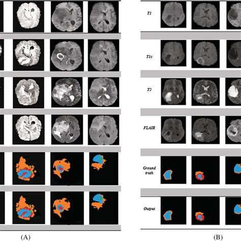 Segmentation Results Of The Proposed Shuffled‐yolo Network For A Download Scientific Diagram