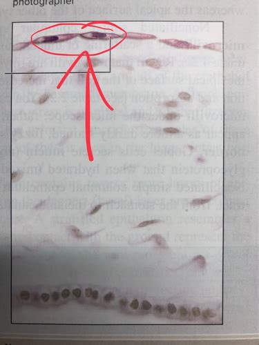 Epithelial Tissues Flashcards Quizlet Epithelial Tissues Flashcards Quizlet